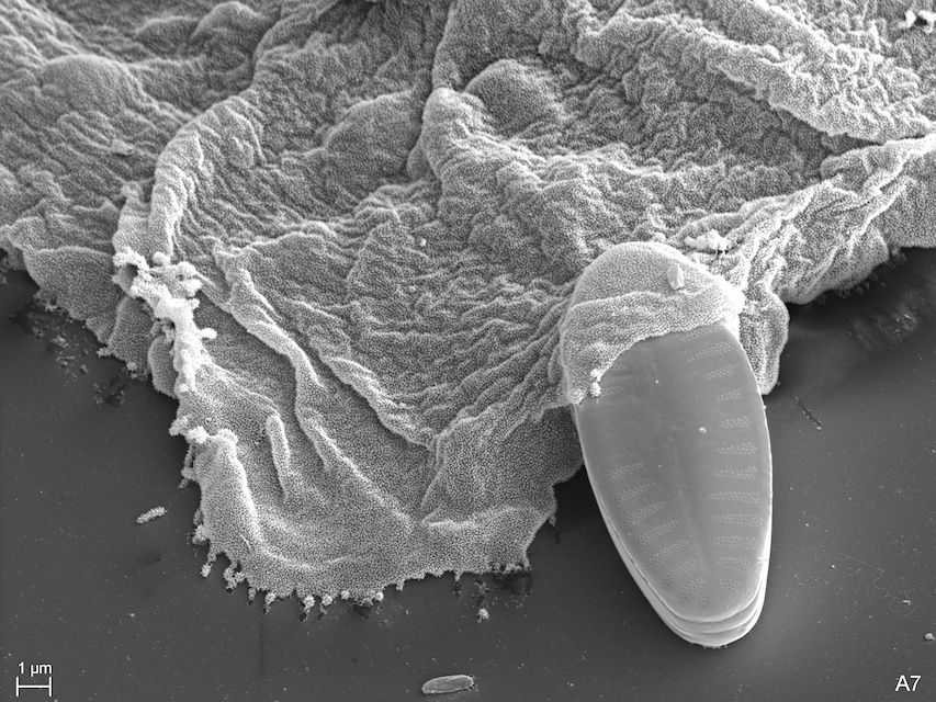 Amoeba - Scanning Electron Microscope images - www.photomacrography.net