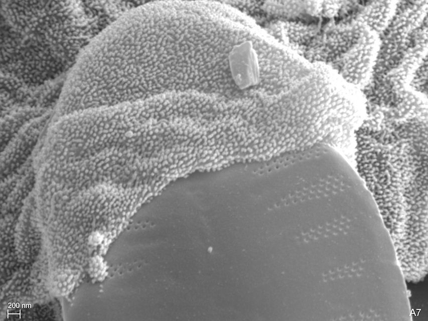 Amoeba - Scanning Electron Microscope images - www.photomacrography.net